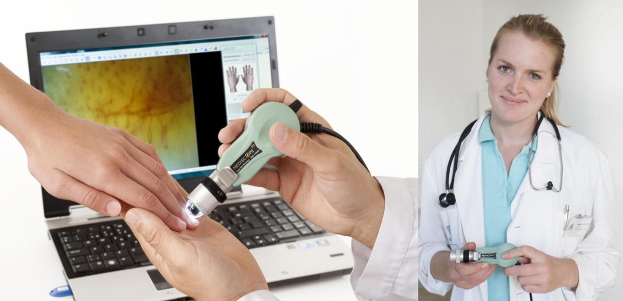 Capilaroscopio Optilia - Ortopedia3D